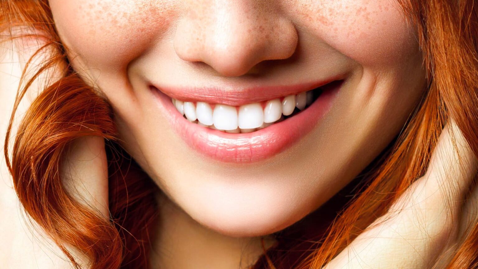 Smile Design – Prime Dent Istanbul